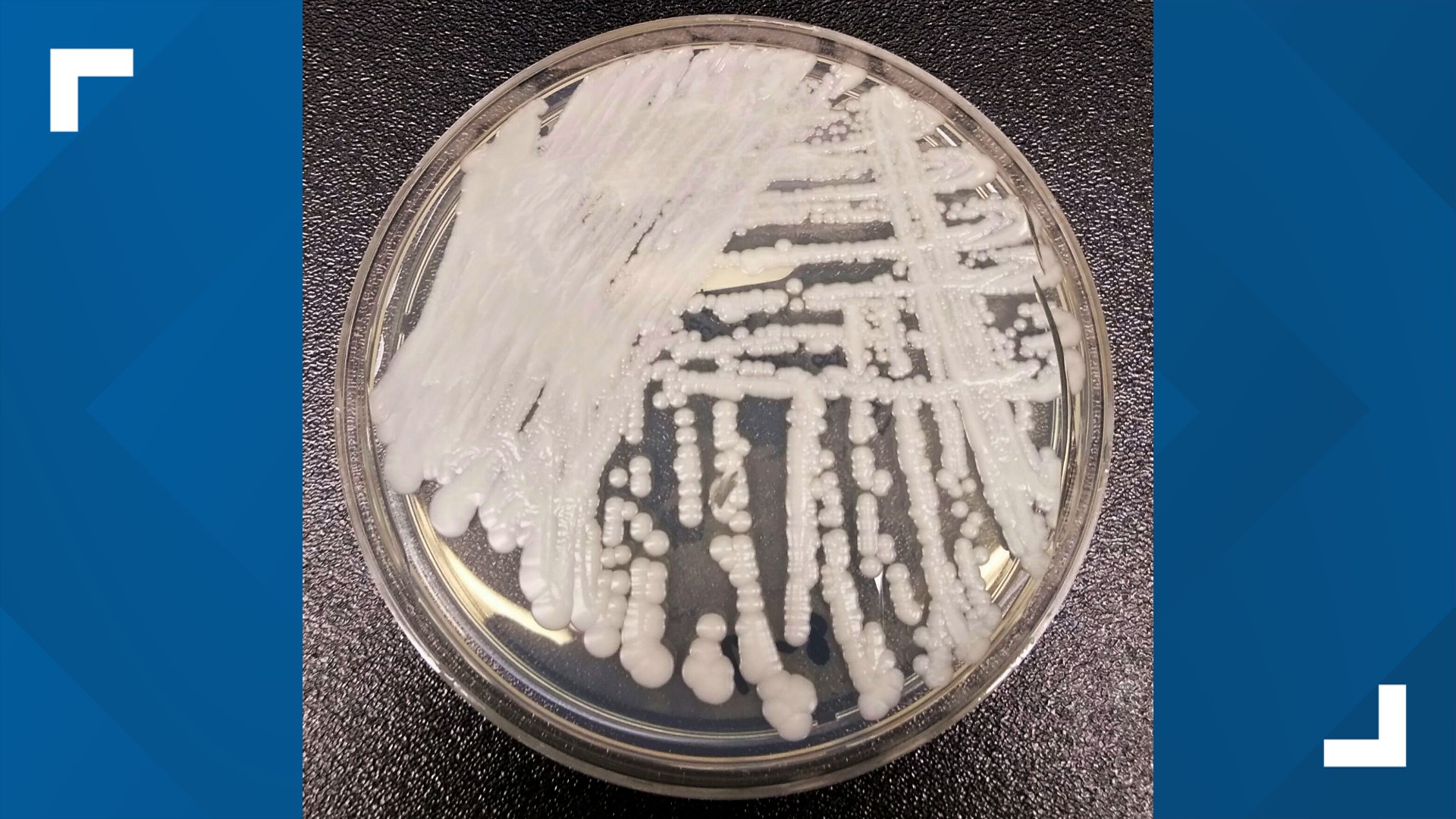 Candida auris: Drug-resistant fungus spreading in US, CDC says | fox43.com