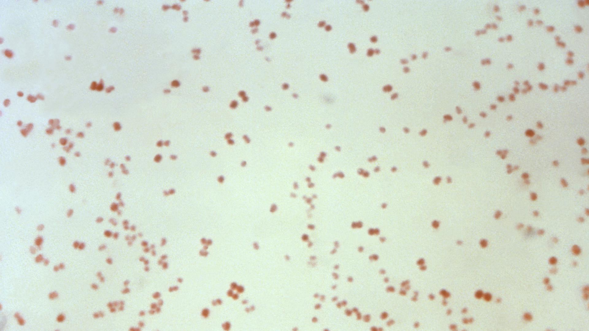 US STD rates drop, but syphilis in babies rise in 2024 | localmemphis.com