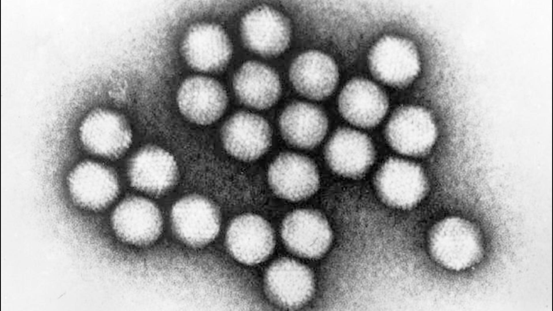 What is adenovirus? What to know about the common respiratory virus ...