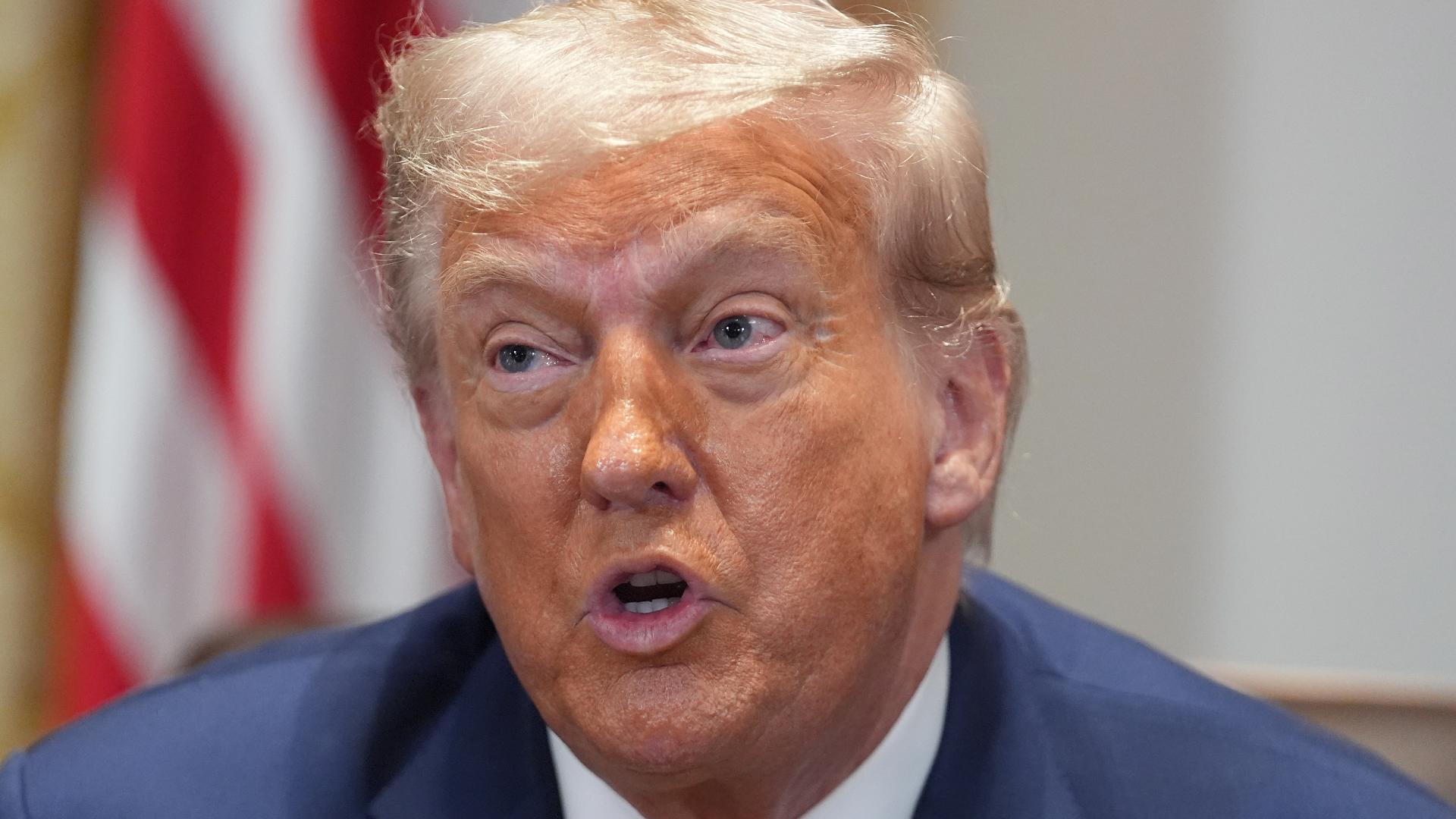 President Donald Trump diagnosed with chronic venous insufficiency | wthr.com