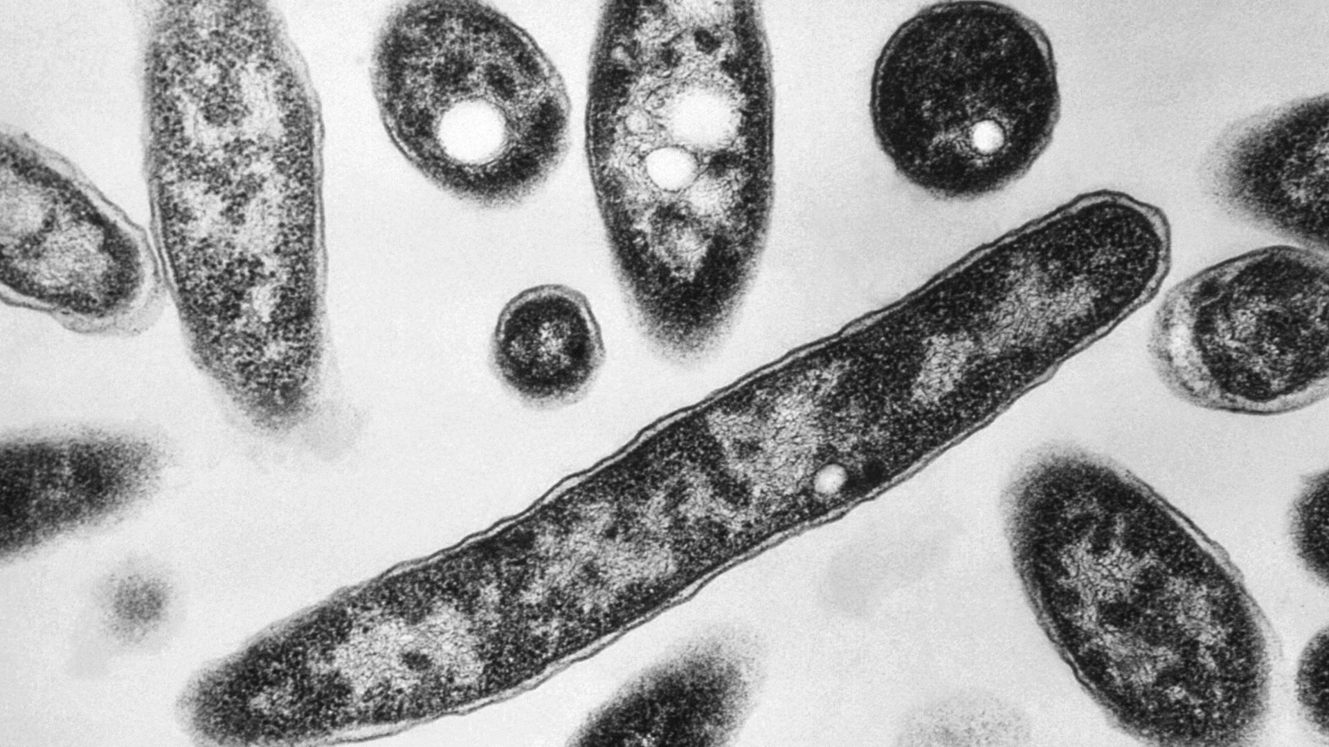 Iowa HHS: Legionnaires' disease cases rise to 74 in Marshall County ...