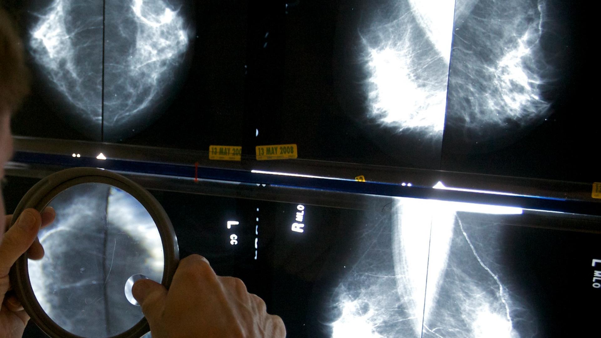 UnityPoint Health to expand cancer care in Des Moines with new clinic ...