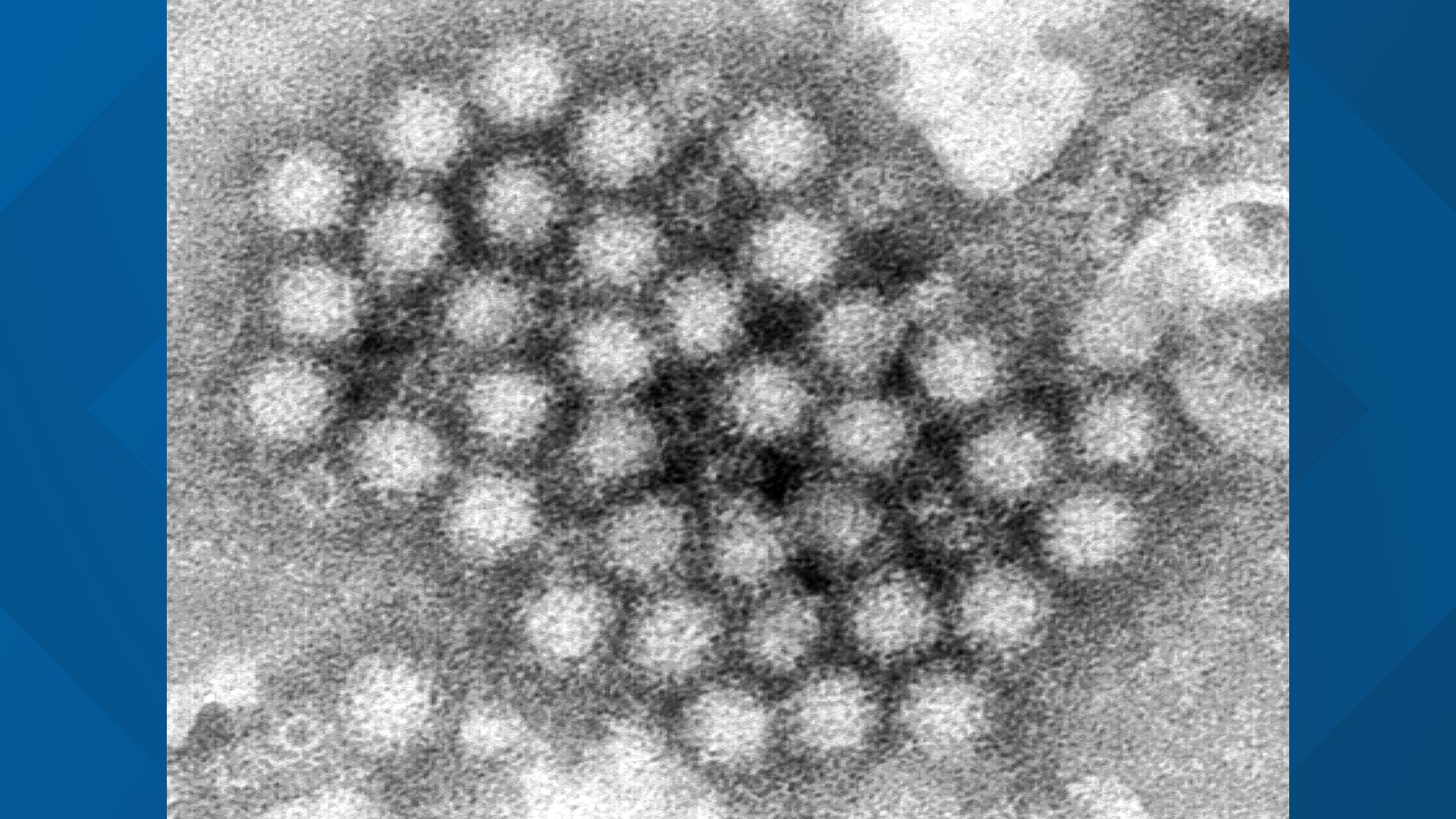 CDC: Norovirus outbreaks, infections surge in US | wthr.com