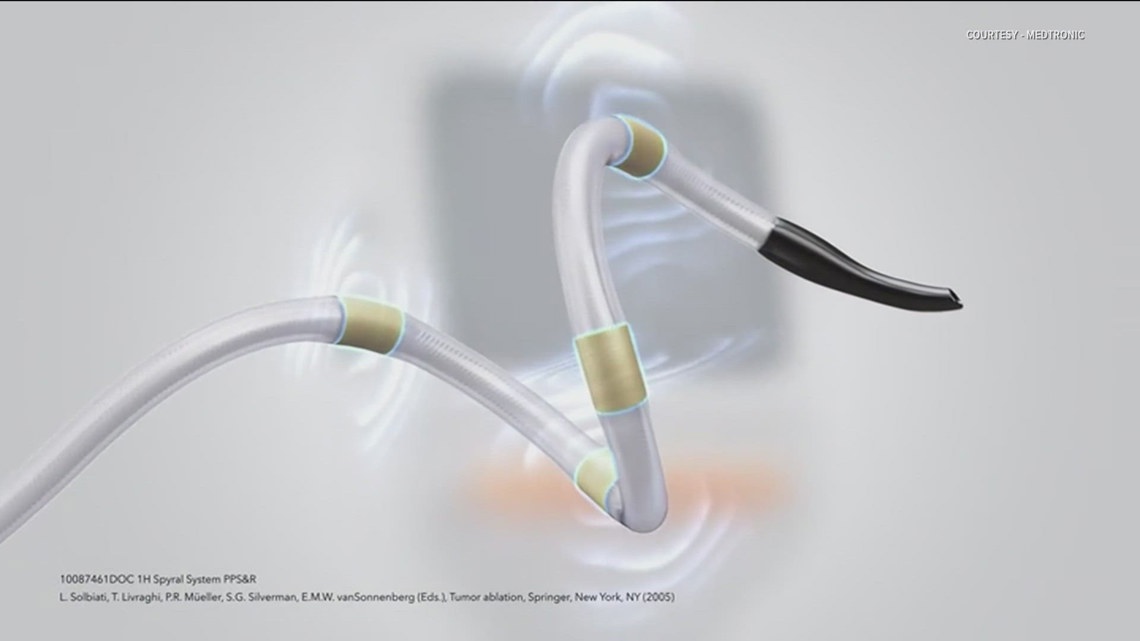 Medtronic CEO on newest procedure, future of medtech industry | wqad.com