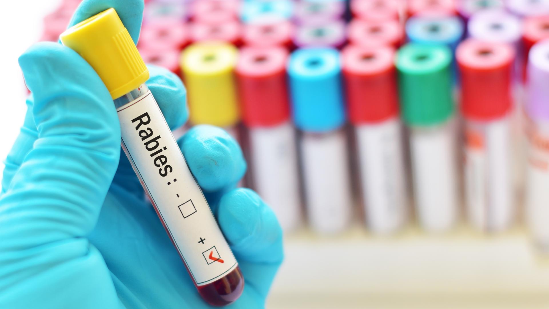 Rabies confirmed in Coffee County horse, officials urge precautions ...