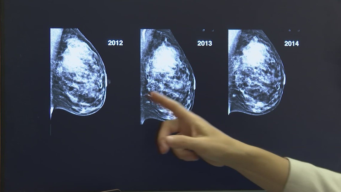 Why it's important to get regular mammograms | 5newsonline.com