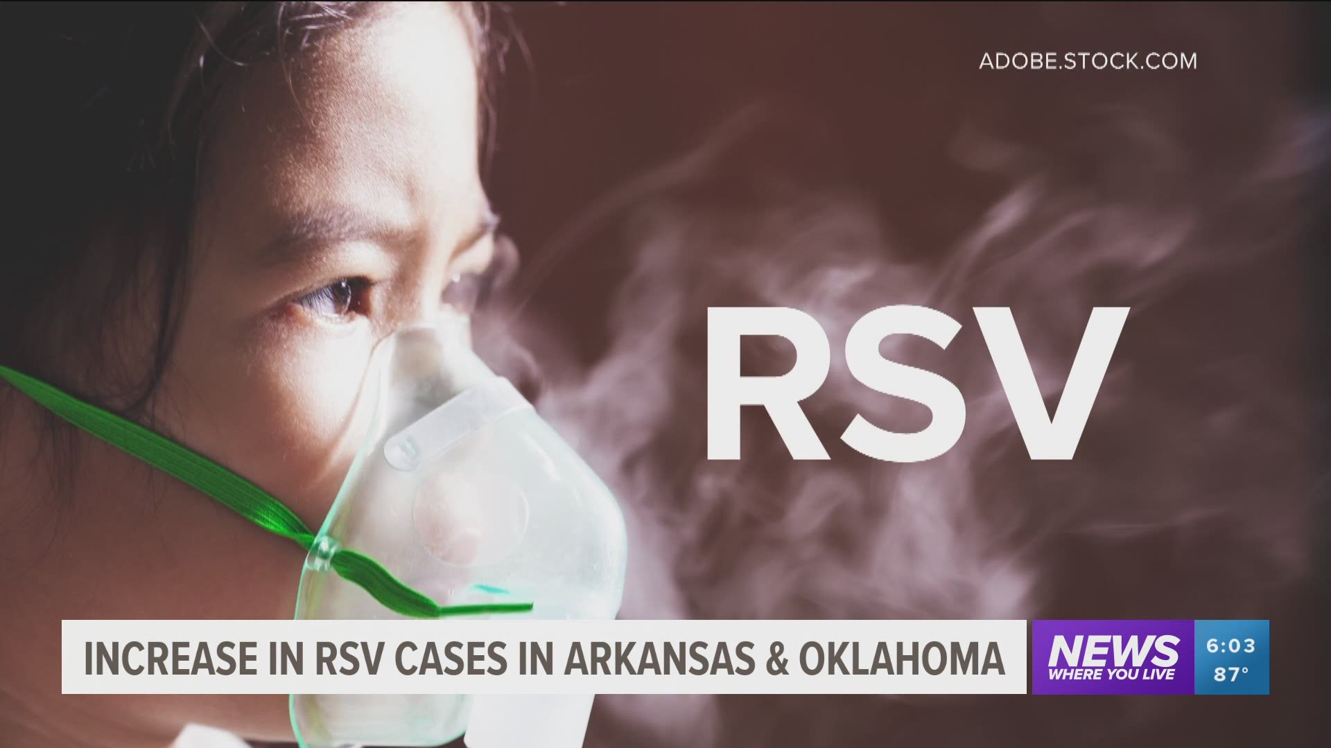 CDC issue health advisory for rise in RSV cases | 5newsonline.com