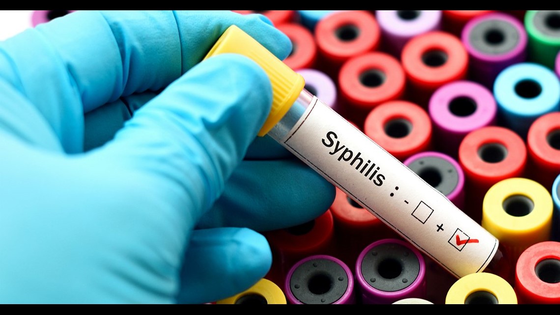 Three STDs Reach All-Time Highs In The US, New CDC Report Says ...