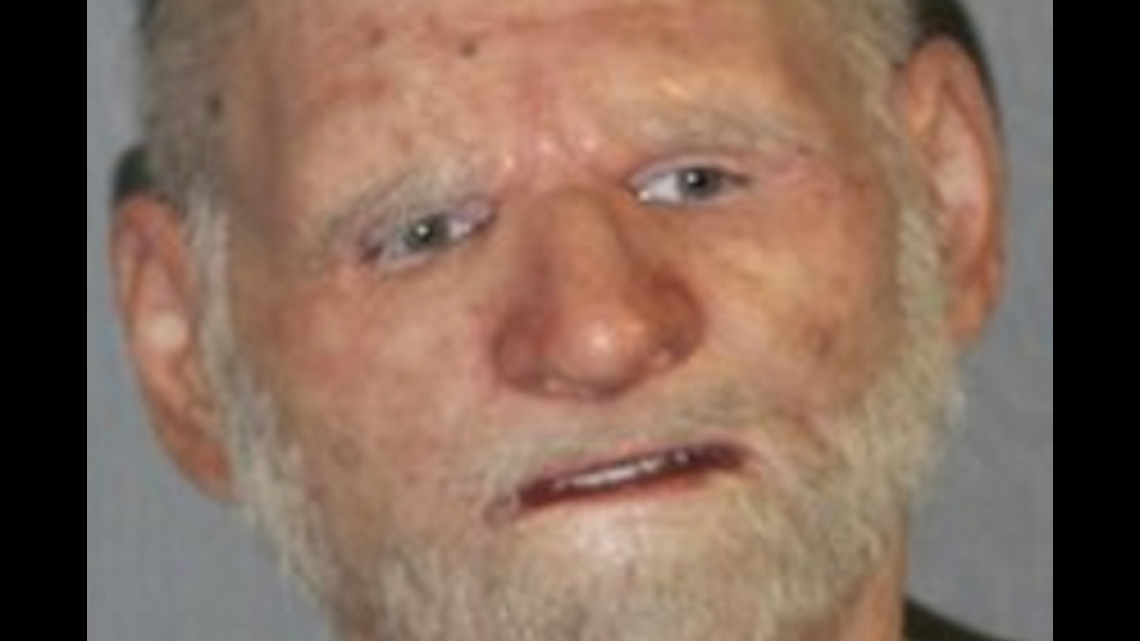 ‘Elderly’ Cape Cod Man Turns Out To Be 31-Year-Old Fugitive ...
