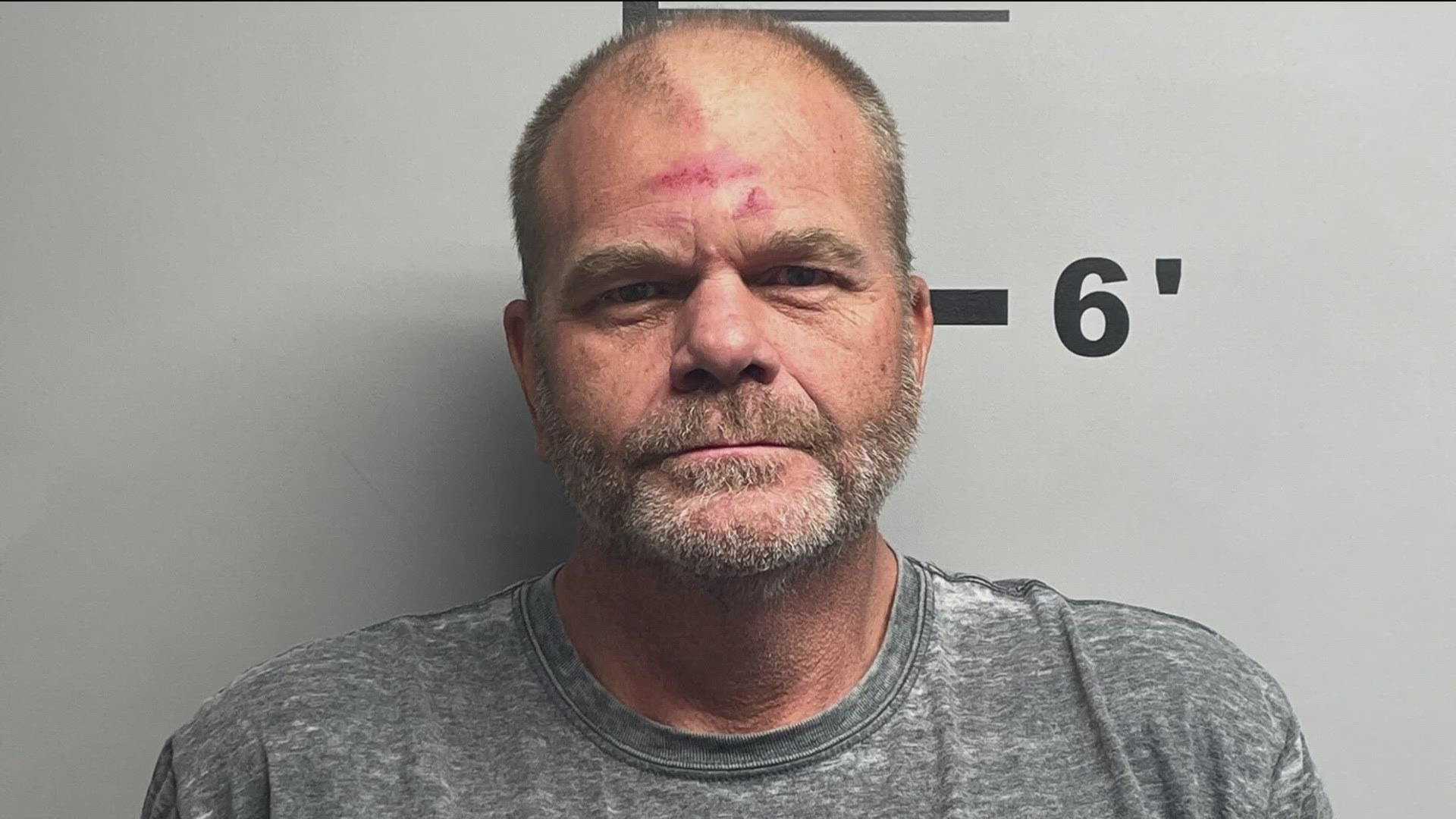FBI seeks help identifying Dr. Hyatt's potential victims | 5newsonline.com