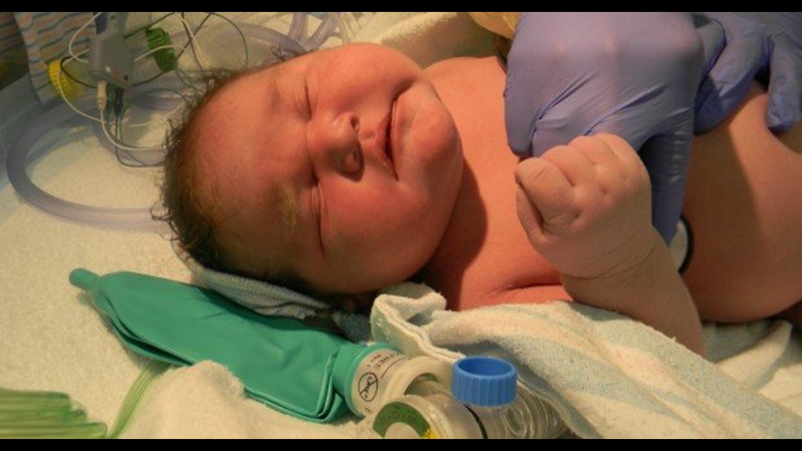 BLOG: 15 Pound Baby Born in CA | 5newsonline.com