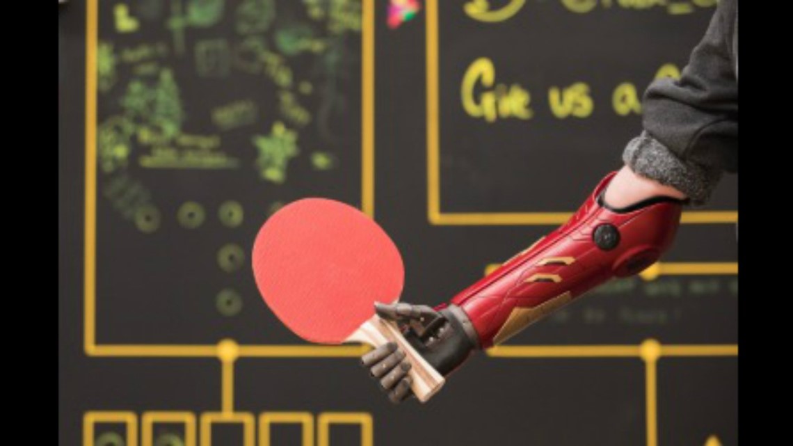 8-Year-Old Makes History With ‘Superhero’ Bionic Arm | 5newsonline.com