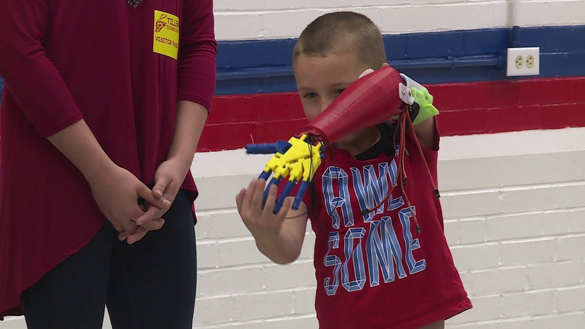 Five-Year-Old Boy Gets 3D-Printed Prosthetic Arm | 5newsonline.com