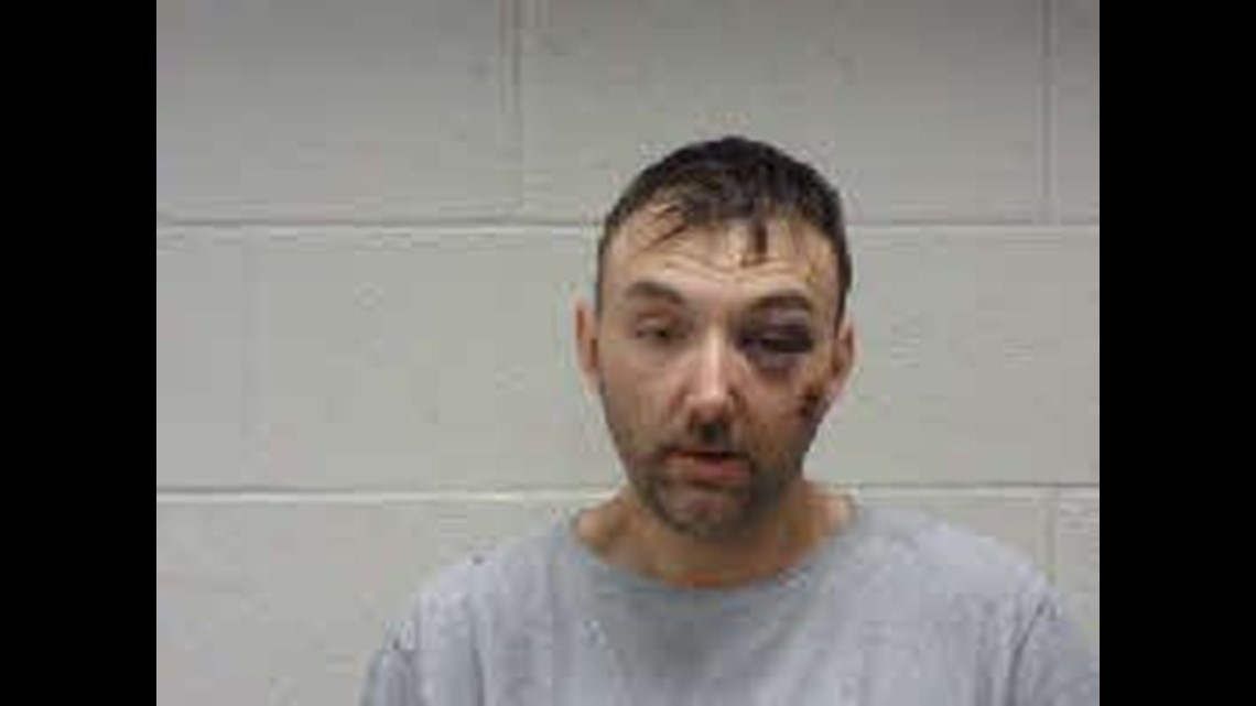 Suspect Stabbed Benton County Man In The Face, Police Say | 5newsonline.com
