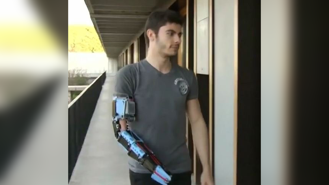 19-Year-Old Born Without Lower Arm Creates Prosthetic Out Of Legos ...