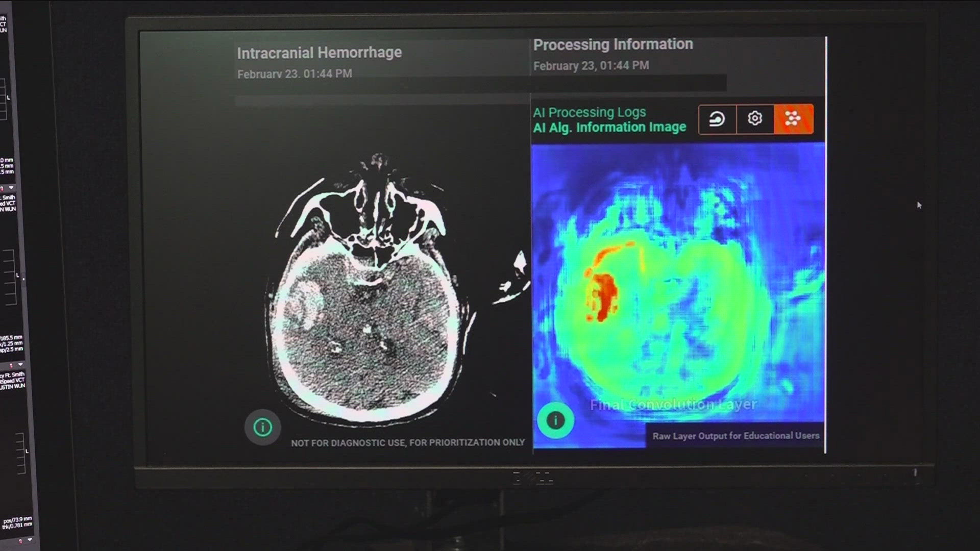 How Mercy Hospitals use AI to improve health outcomes | 5newsonline.com