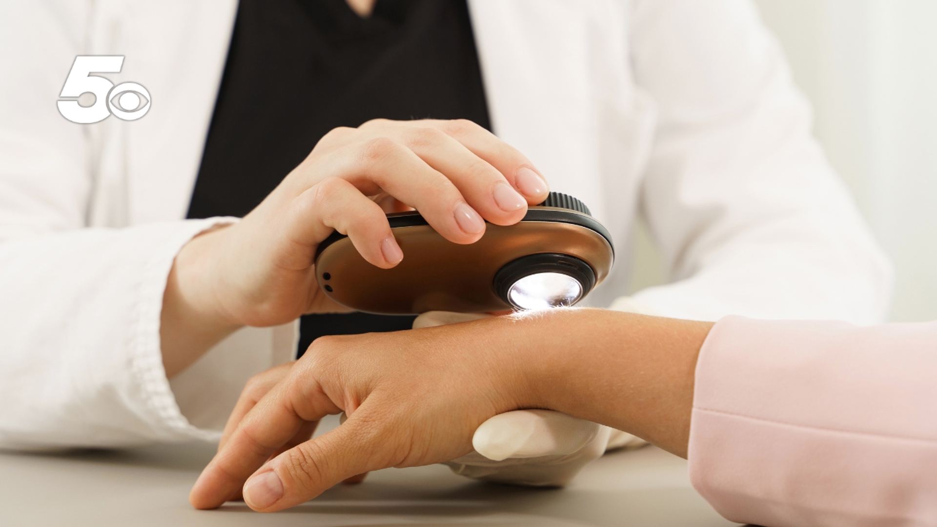 Experts stress early detection, prevention during Skin Cancer Awareness ...