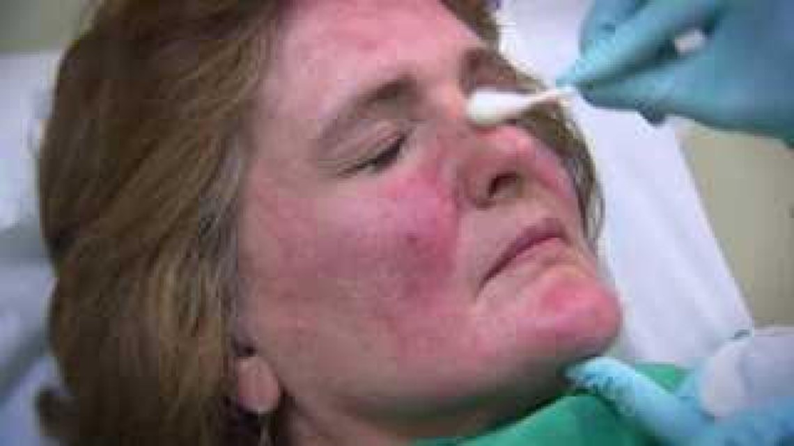 VIDEO: Detecting Skin Cancer Early | 5newsonline.com