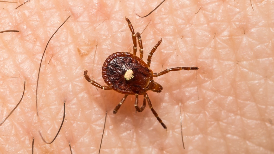 Doctor describes life with tick-borne condition, alpha-gal ...
