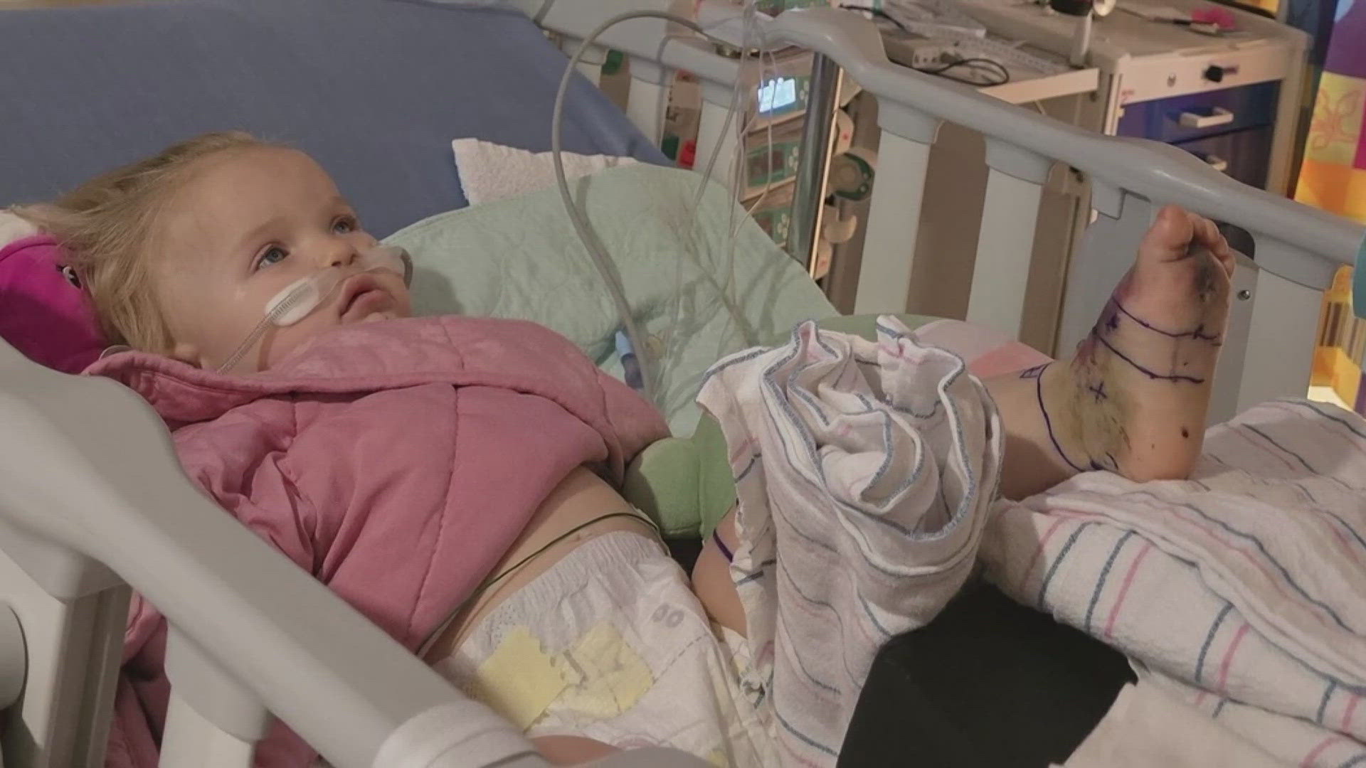 Arizona toddler recovers from 2 rattlesnake bites | 10tv.com