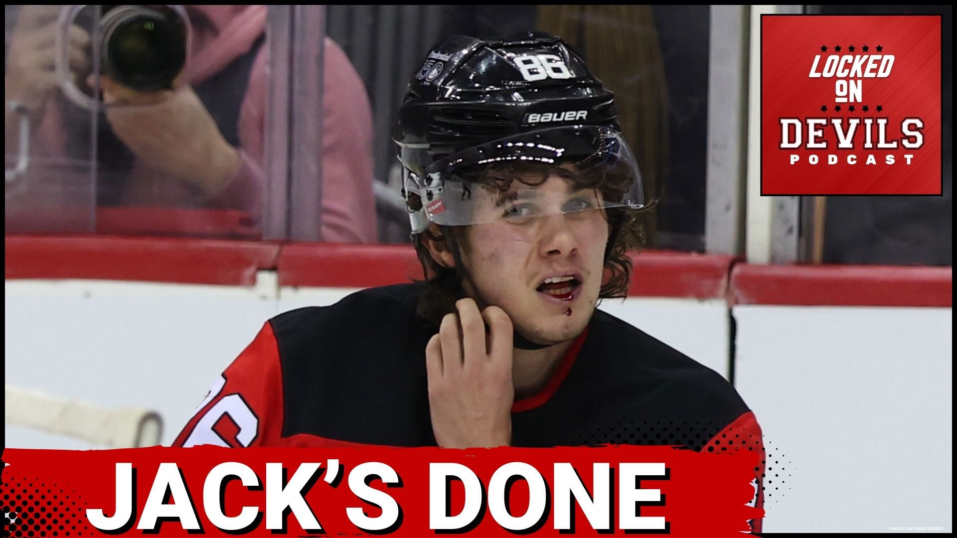 Jack Hughes' Season is Now Over...He Recently Got Shoulder Surgery ...
