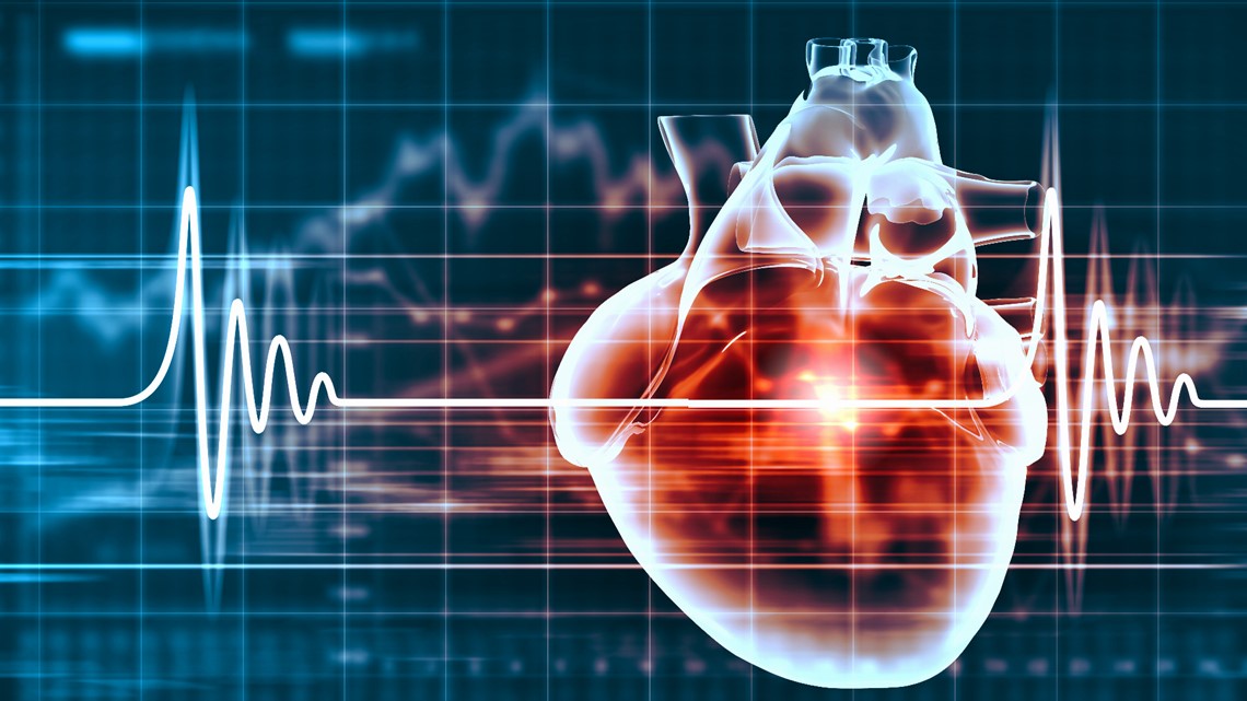 Memphis Veterans Administration performs first case of Micra Pacemaker ...