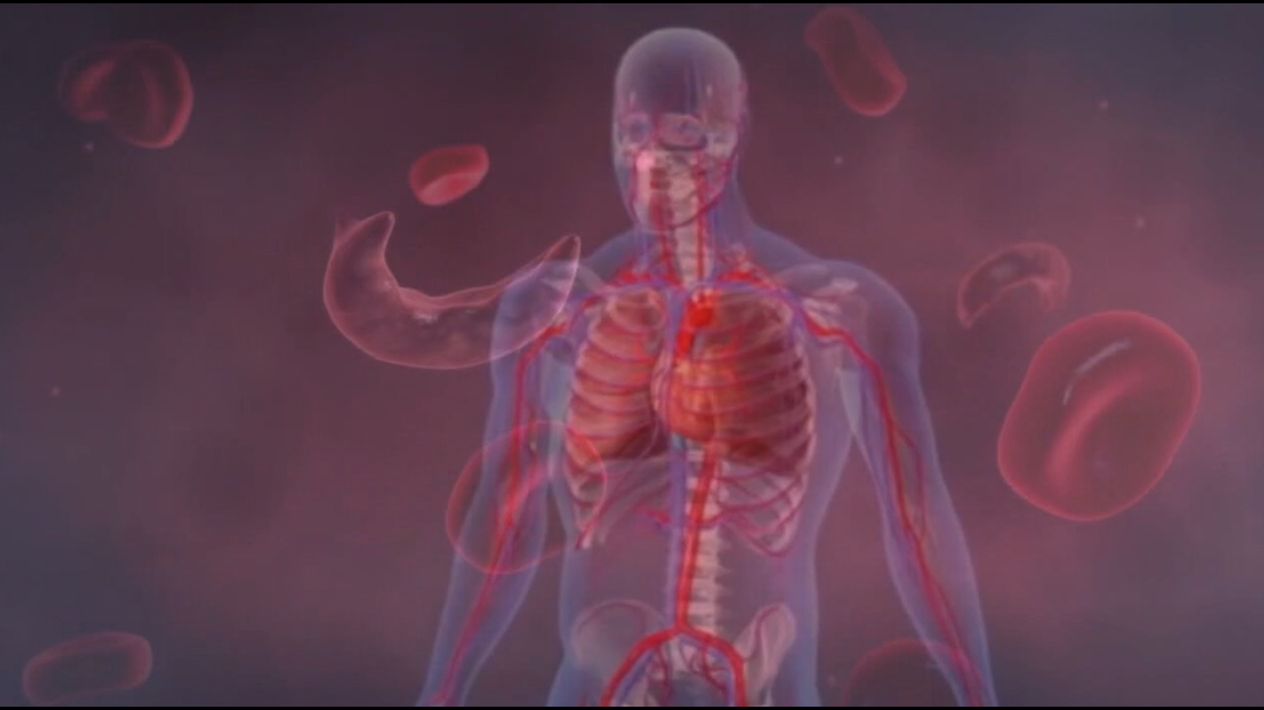 UTHSC to start Sickle Cell Boot Camp for nurses | localmemphis.com