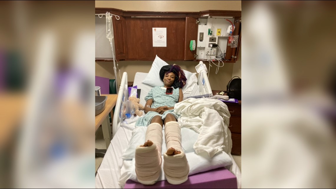 A hit-and-run survivor talks about her new perspective on life ...