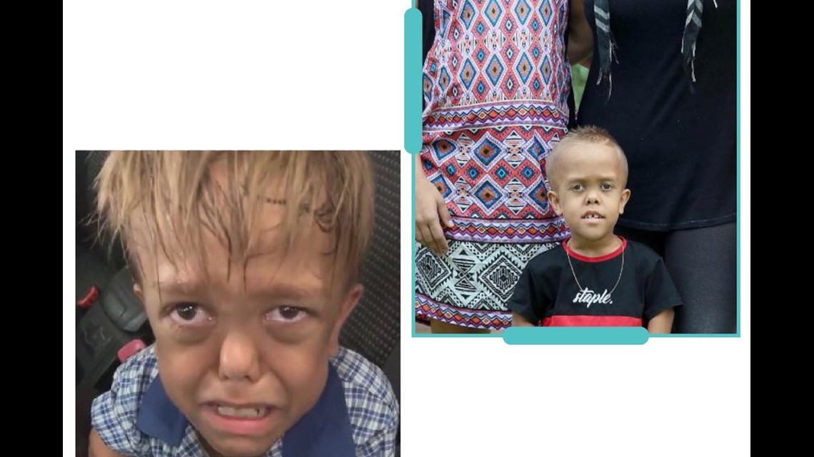 Bullied for dwarfism, this Australian boy’s tearful message went viral ...