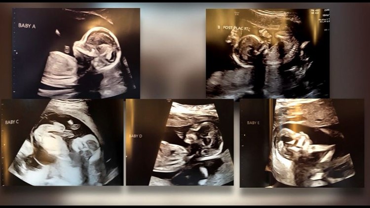 Northeast Ohio couple expecting quintuplets | 10tv.com