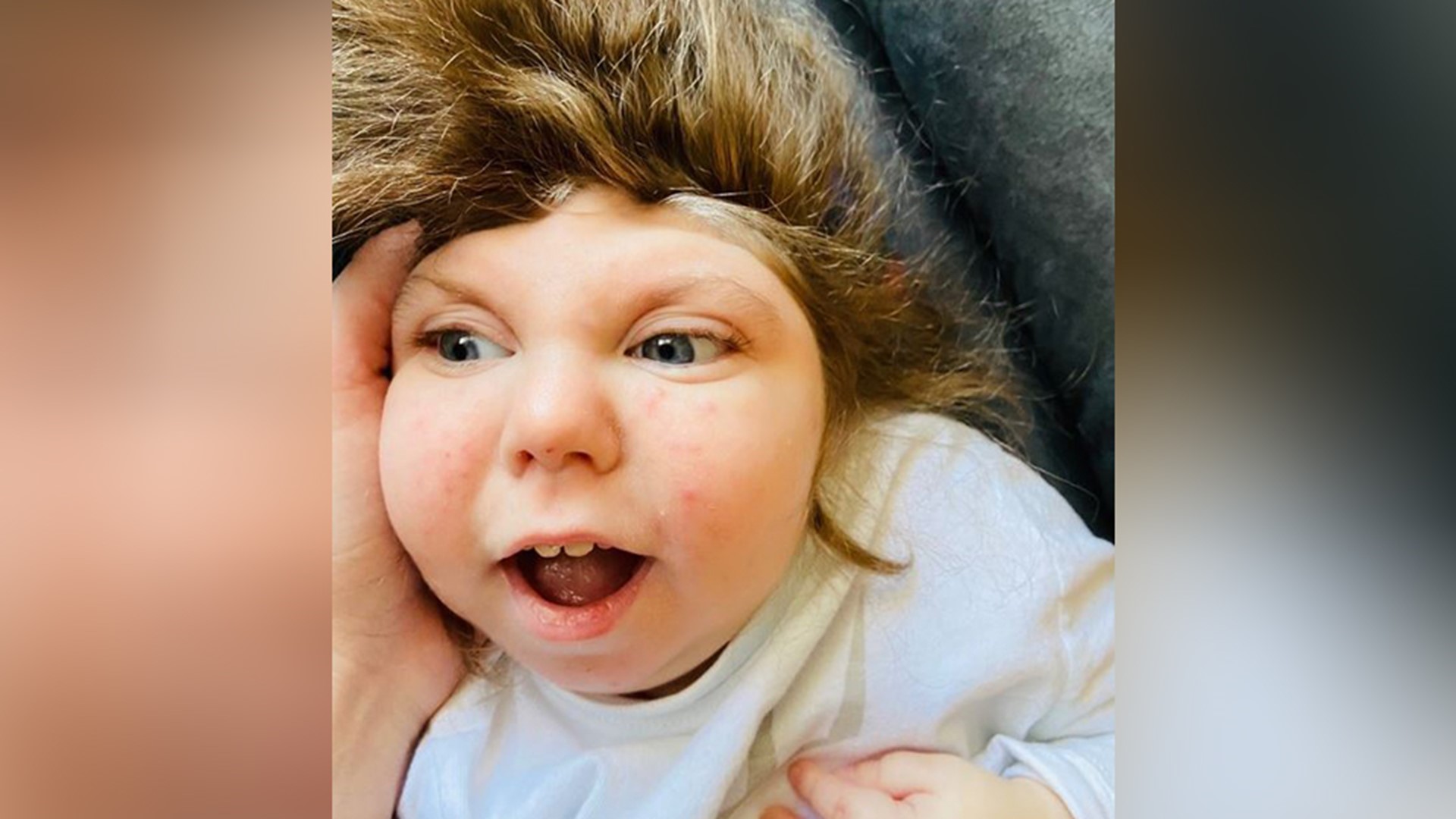 5-year-old boy born without most of his brain dies after years of ...