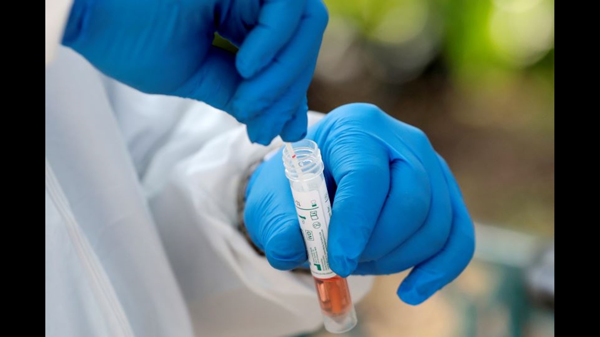 Quick antigen test for COVID-19 gets emergency FDA approval | 10tv.com