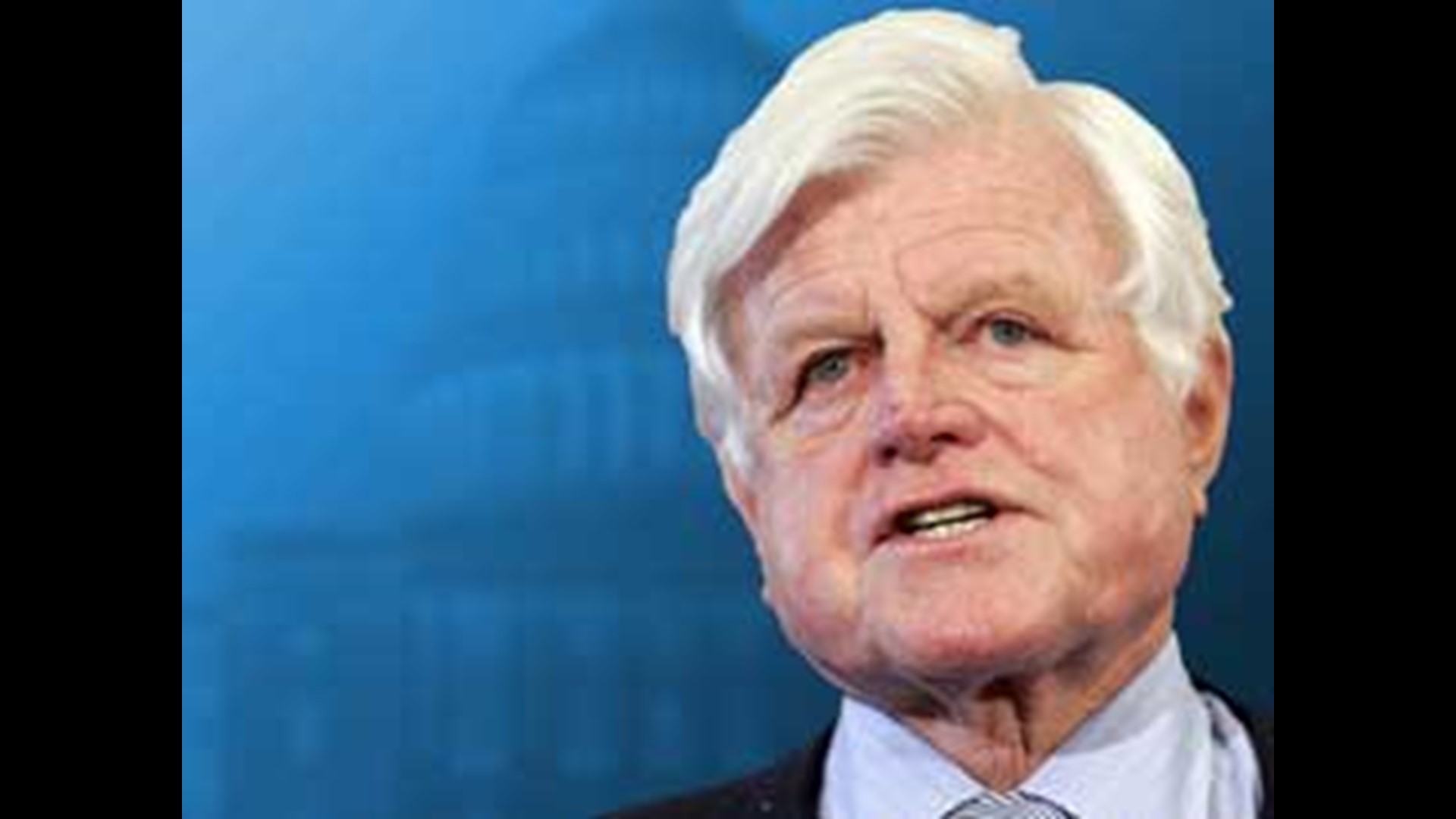 Sen. Kennedy Diagnosed With Brain Tumor | 10tv.com