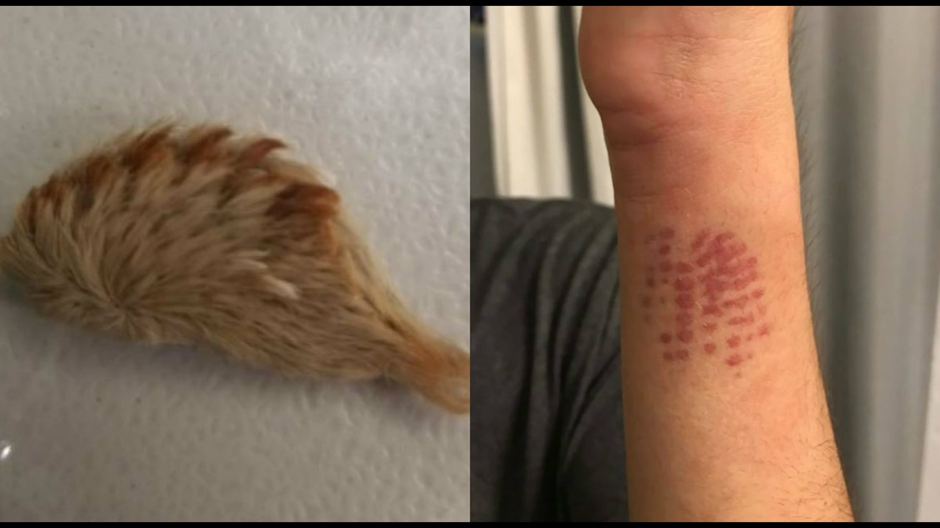 Teen hospitalized after touching venomous caterpillar | 10tv.com