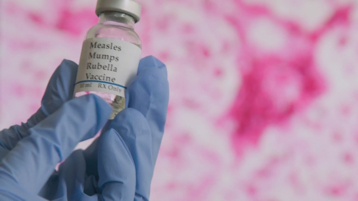 What to know about measles, how to prevent it | 10tv.com