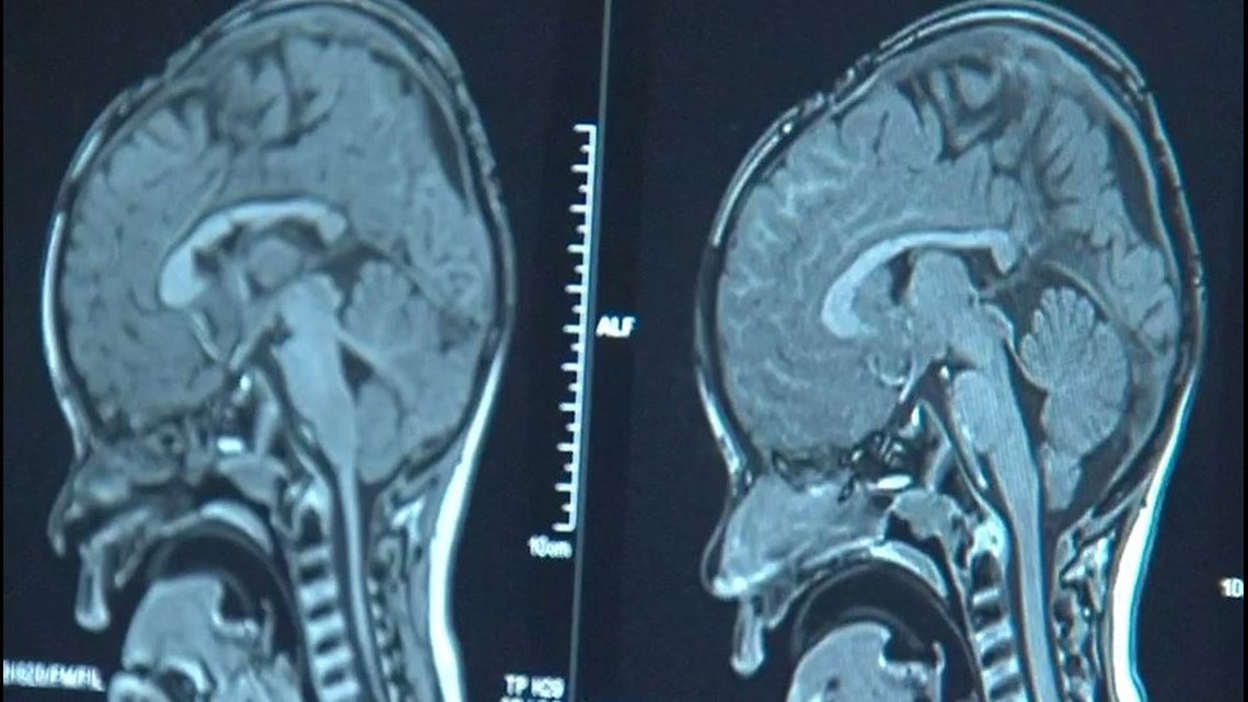 Study: Thinking too much can cause you to die sooner | 10tv.com
