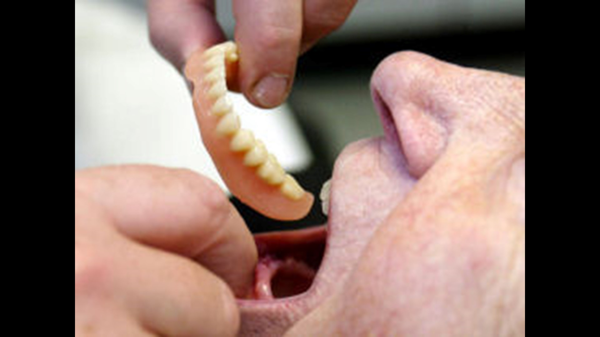 Foreign Dental Work Put To Test | 10tv.com
