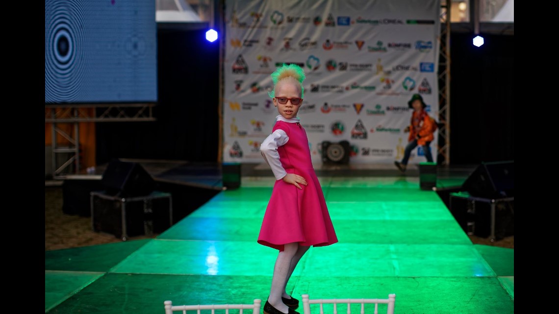 A groundbreaking beauty pageant for those with albinism | 10tv.com