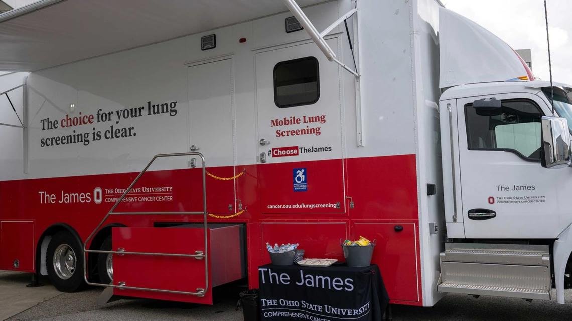 Ohio launches first mobile lung cancer screening unit | 10tv.com