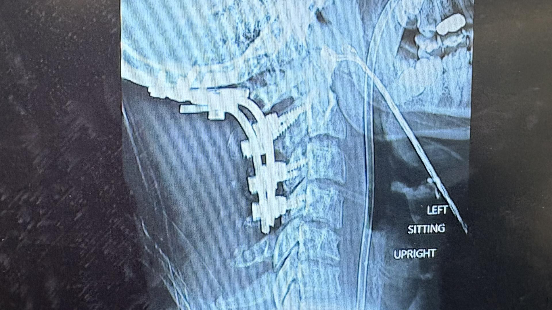 'Tomorrow is not guaranteed': Ohio man survives rare internal ...