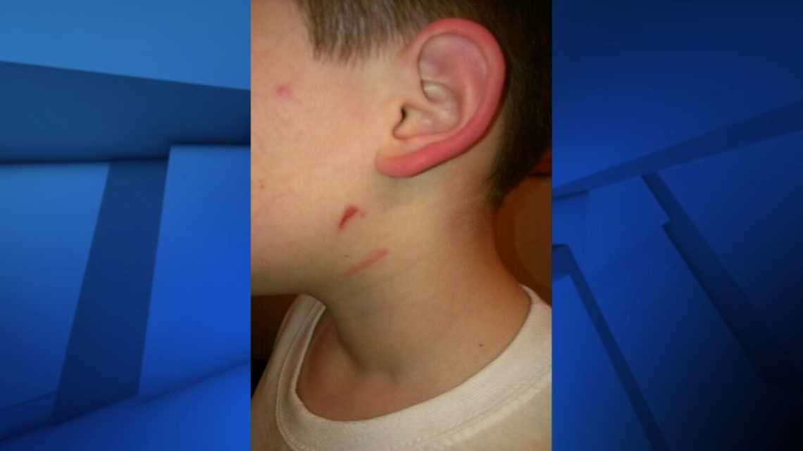 Teacher Pulled From Classroom After Student Comes Home With Scratches ...