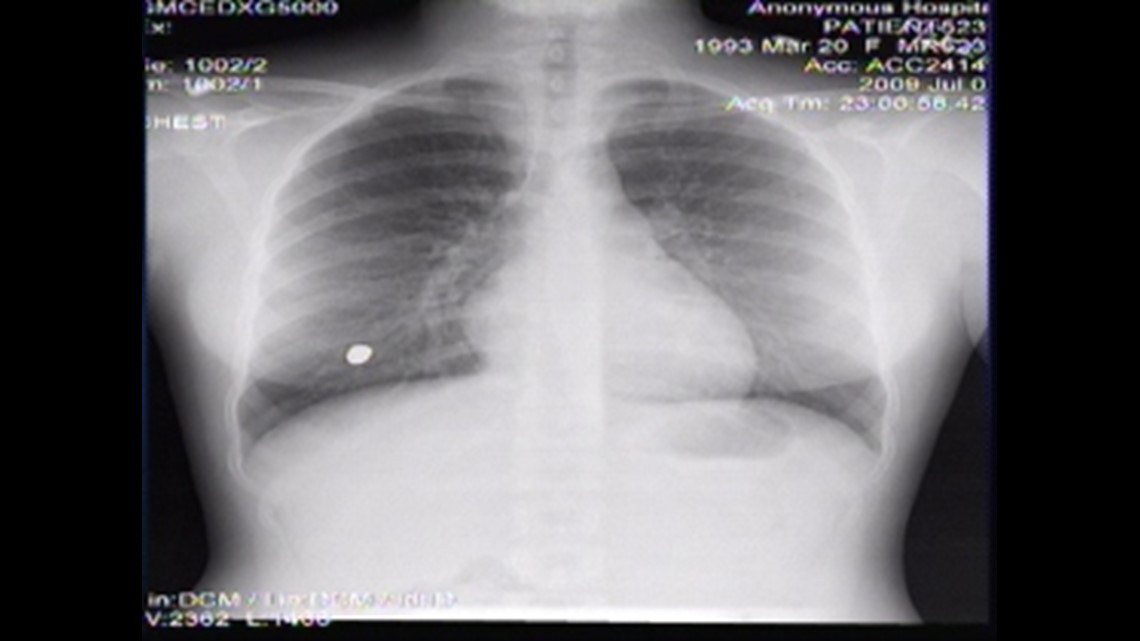Girl Shot In Chest At Red, White & Boom | 10tv.com