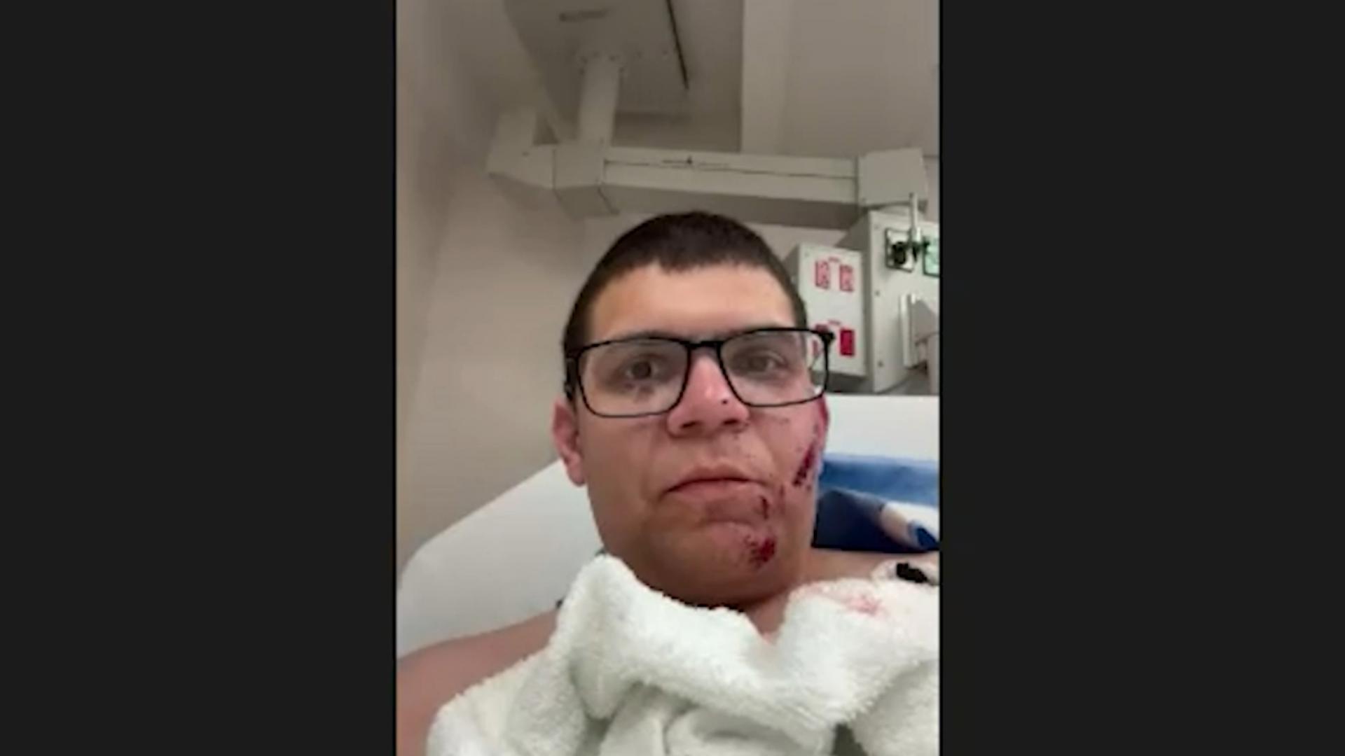 Extended interview: Victim recounts apparent road rage shooting on I-70 ...