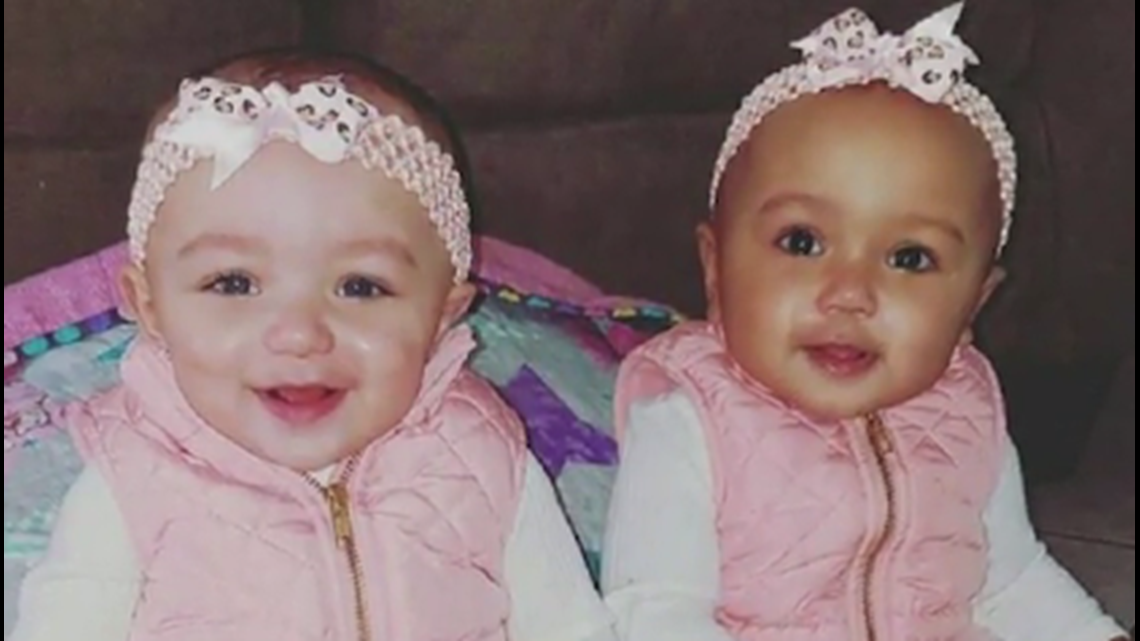 Twin baby girls have different skin colors | 10tv.com