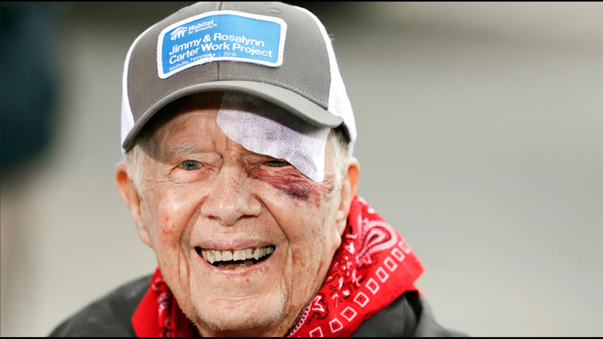 Jimmy Carter recovering after surgery on brain for subdural hematoma ...