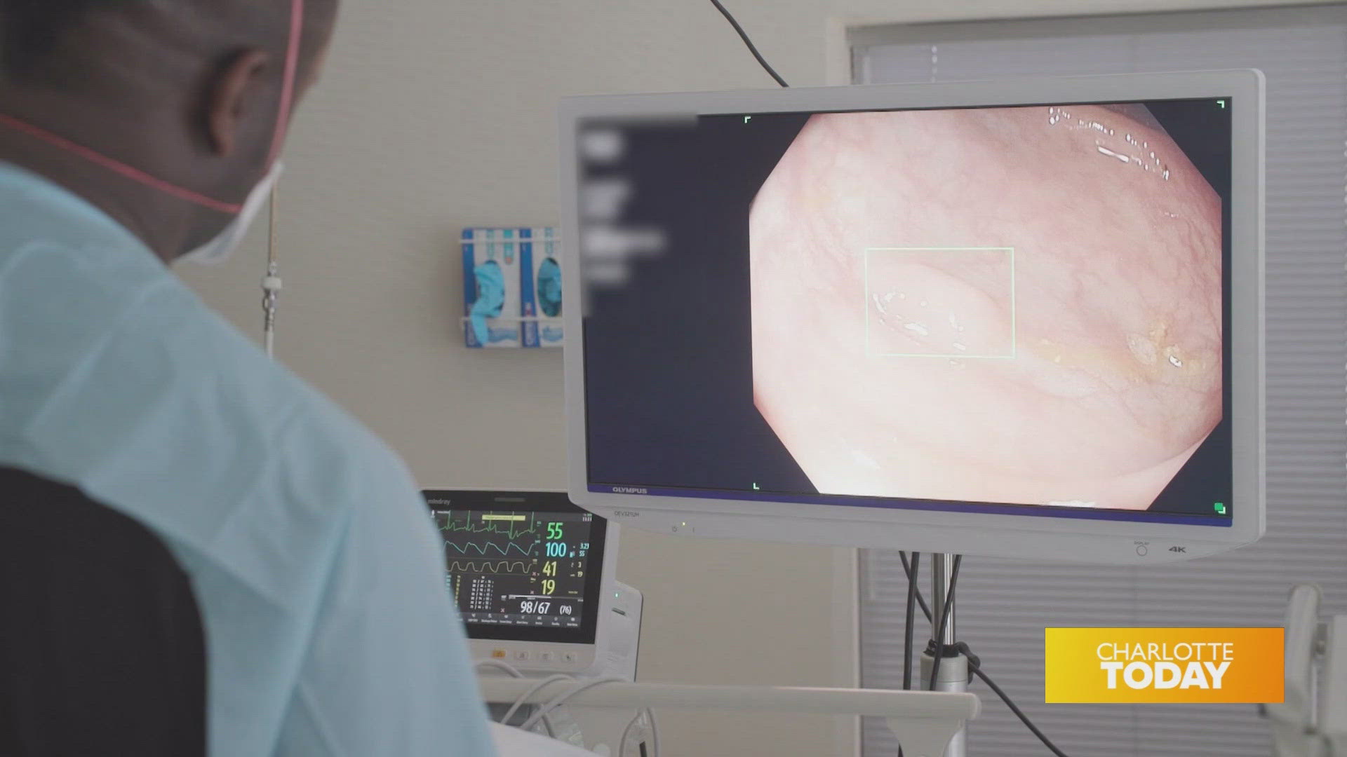 AI is Revolutionizing the way Colonoscopies are screened and data is ...