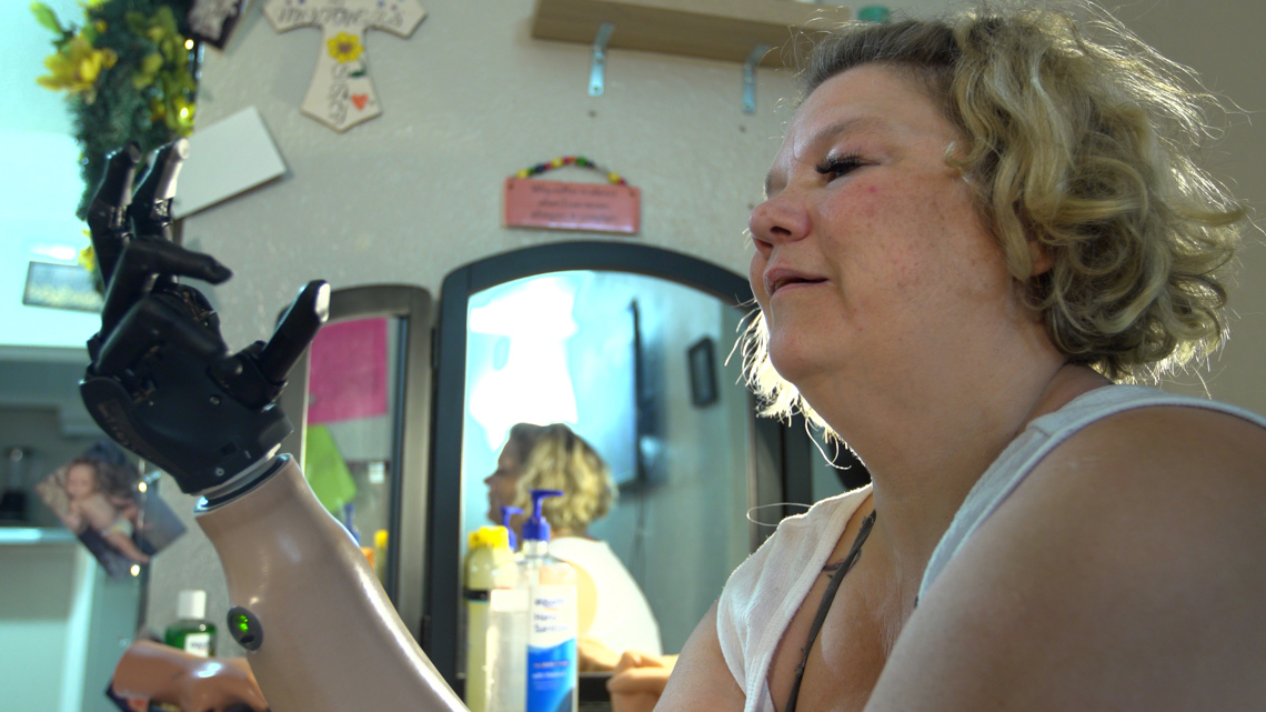 A helping hand: Strangers offer quadruple amputee the gift of hope ...