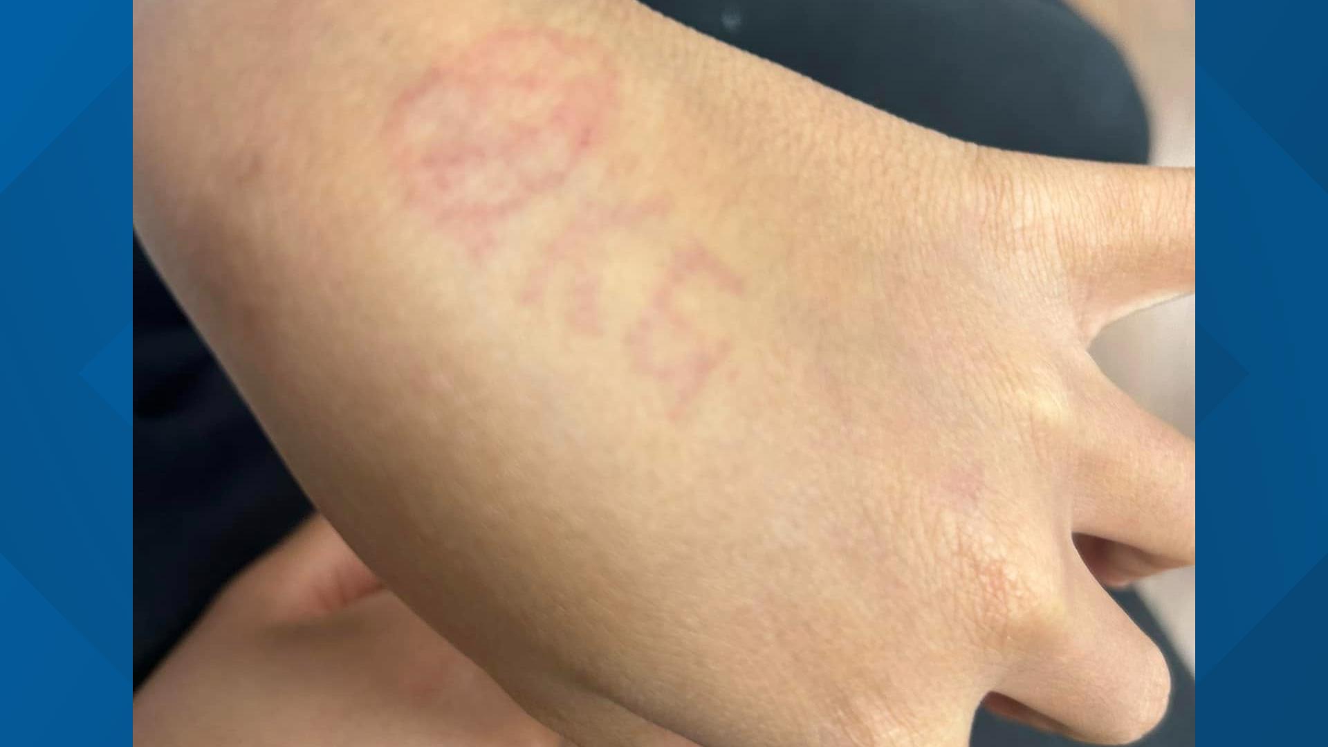 Greenville, TX: Middle school students give each other tattoos ...