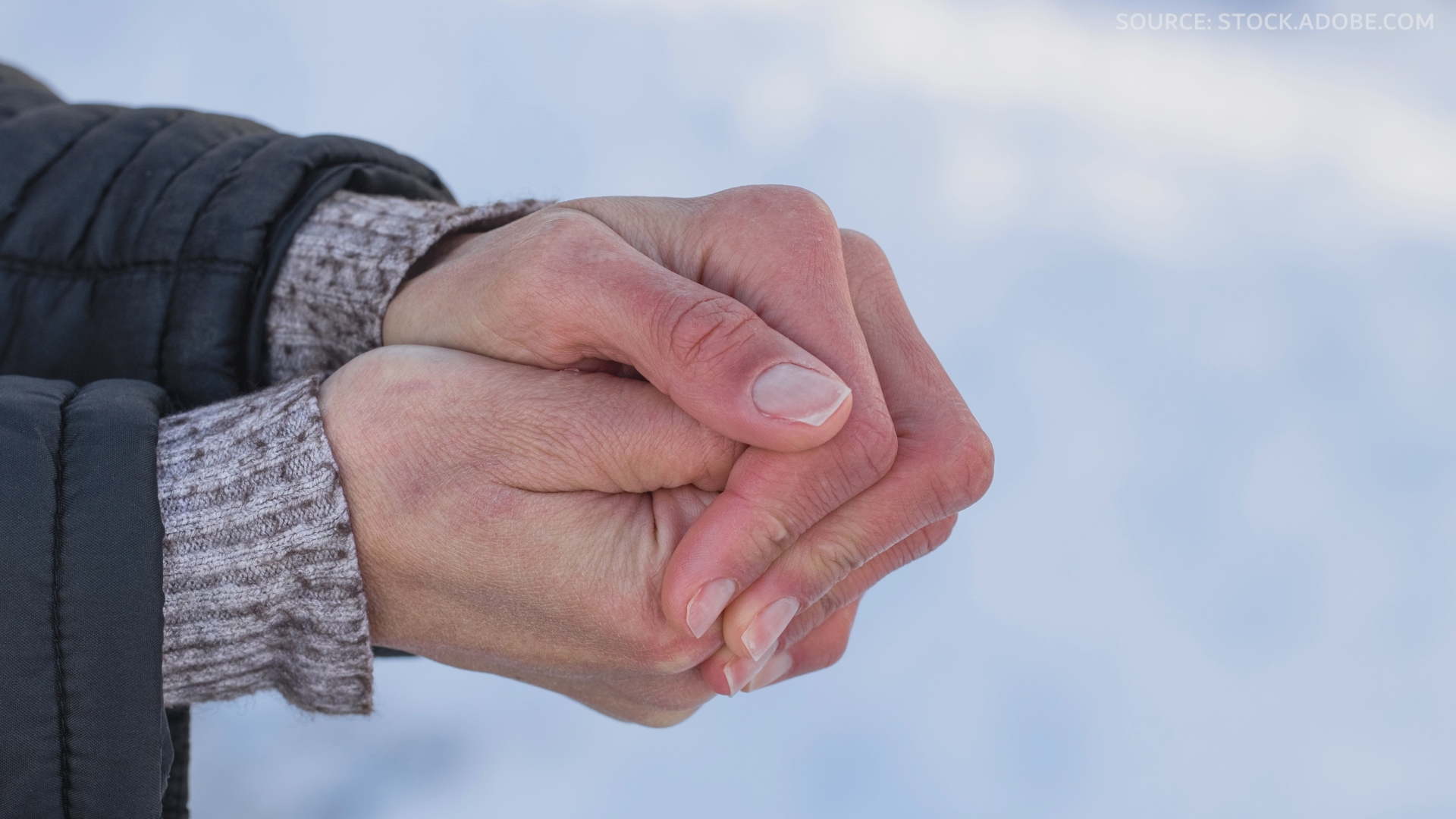 What is frostbite? Here’s how to spot the signs early | rocketcitynow.com