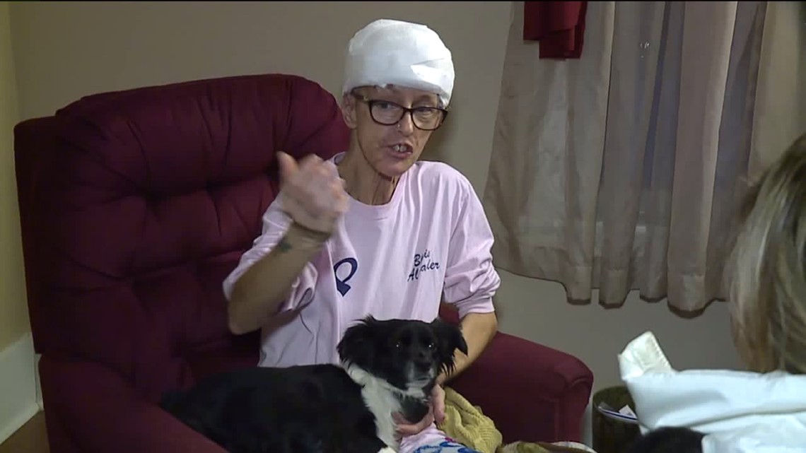 Bear Attack Victim Recalls Terrifying Night | wnep.com